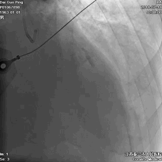 推进区域协同救治工作，实现STEMI双绕常态化 -- 严道医声网