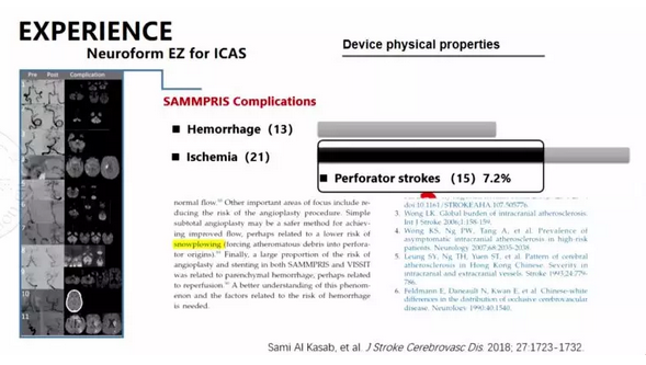 NEIMS 2018｜王君：Neuroform EZ 支架在症状性颅内动脉狭窄中的初步应用 -- 严道医声网