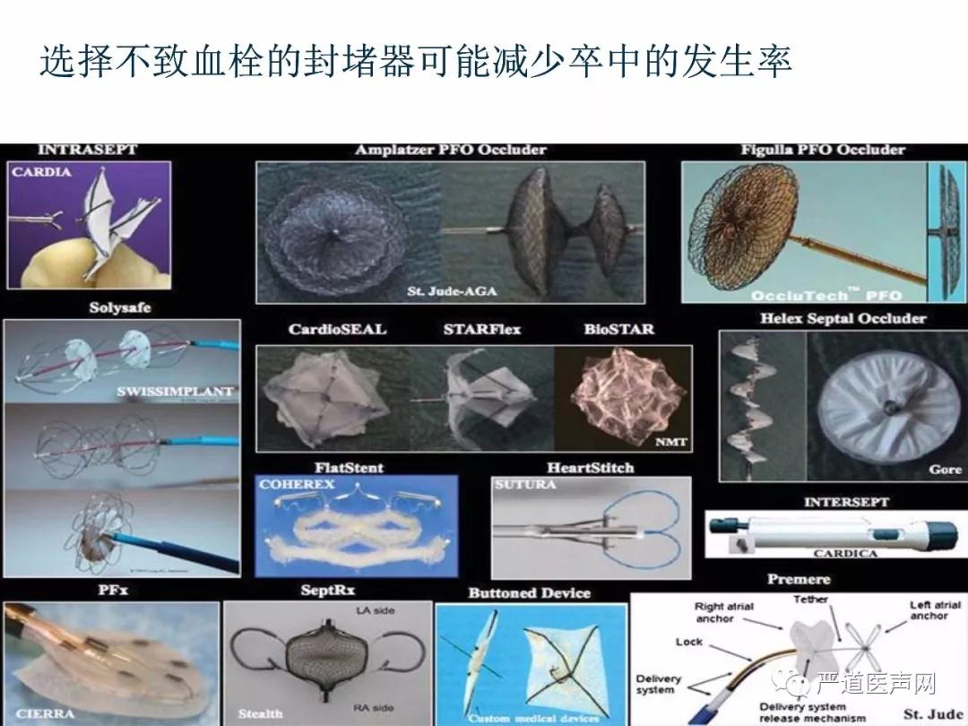 精品课程 | 张玉顺：PFO手术流程及临床研究更新 -- 严道医声网