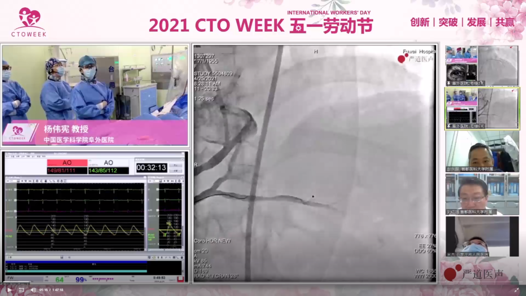 CTO WEEK丨中国医学科学院阜外医院：游刃有余，临危不乱，8台手术联播彰显阜外力量 -- 严道医声网