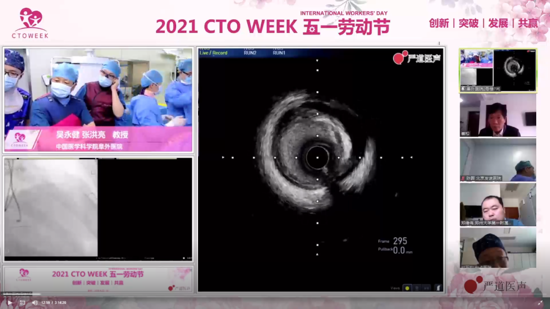 CTO WEEK丨中国医学科学院阜外医院：游刃有余，临危不乱，8台手术联播彰显阜外力量 -- 严道医声网