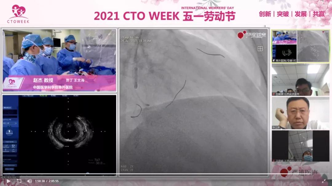 CTO WEEK丨中国医学科学院阜外医院：游刃有余，临危不乱，8台手术联播彰显阜外力量 -- 严道医声网