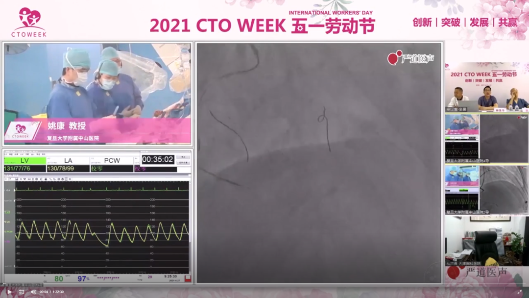 CTO WEEK丨复旦大学附属中山医院：以简驭繁制胜6例CTO病变，薪火相传守望CTO WEEK会议情怀 -- 严道医声网