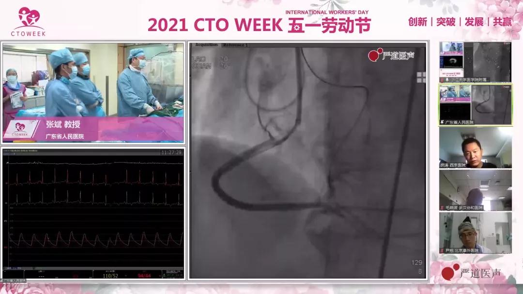 CTO WEEK丨广东省人民医院张斌教授团队：见微知著，精准施策，攻克3台高难度CTO手术 -- 严道医声网