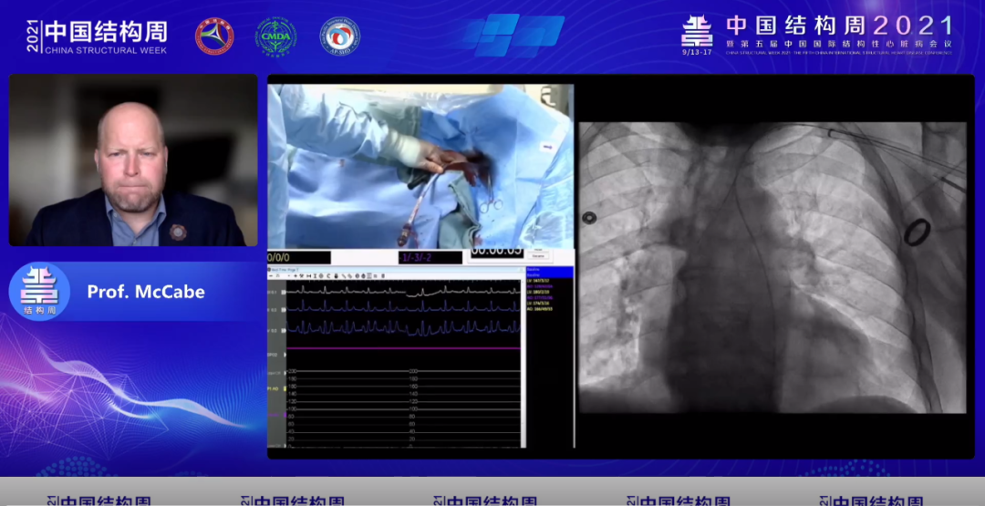 中国结构周2021亮点速递丨超声引导下经皮腋动脉TAVR创新手术形式，经腔静脉入路TAVR手术全流程操作国内首播，震撼四座！ -- 严道医声网