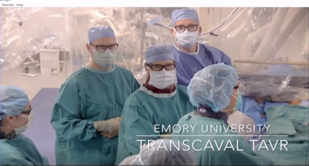 中国结构周2021亮点速递丨超声引导下经皮腋动脉TAVR创新手术形式，经腔静脉入路TAVR手术全流程操作国内首播，震撼四座！ -- 严道医声网