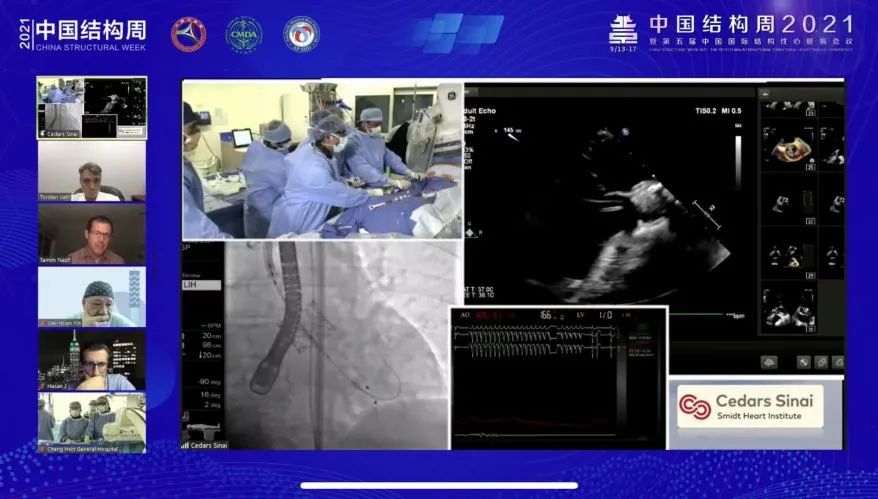 中国结构周2021｜国际频道第四日回归TAVR经典话题，共话复杂TAVR的现在与未来 -- 严道医声网