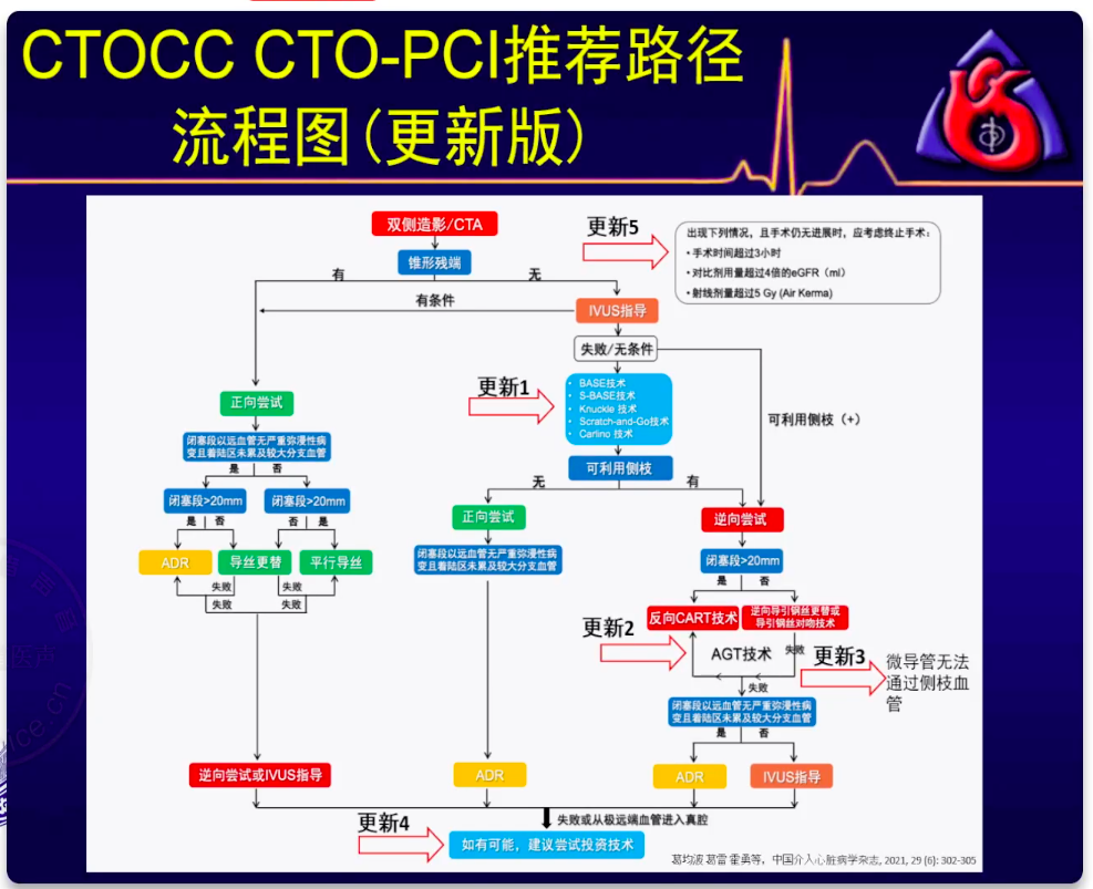 CTOCC 2021 | 葛均波：CTOCC CTO PCI推荐路径更新与新器械的选择 -- 严道医声网