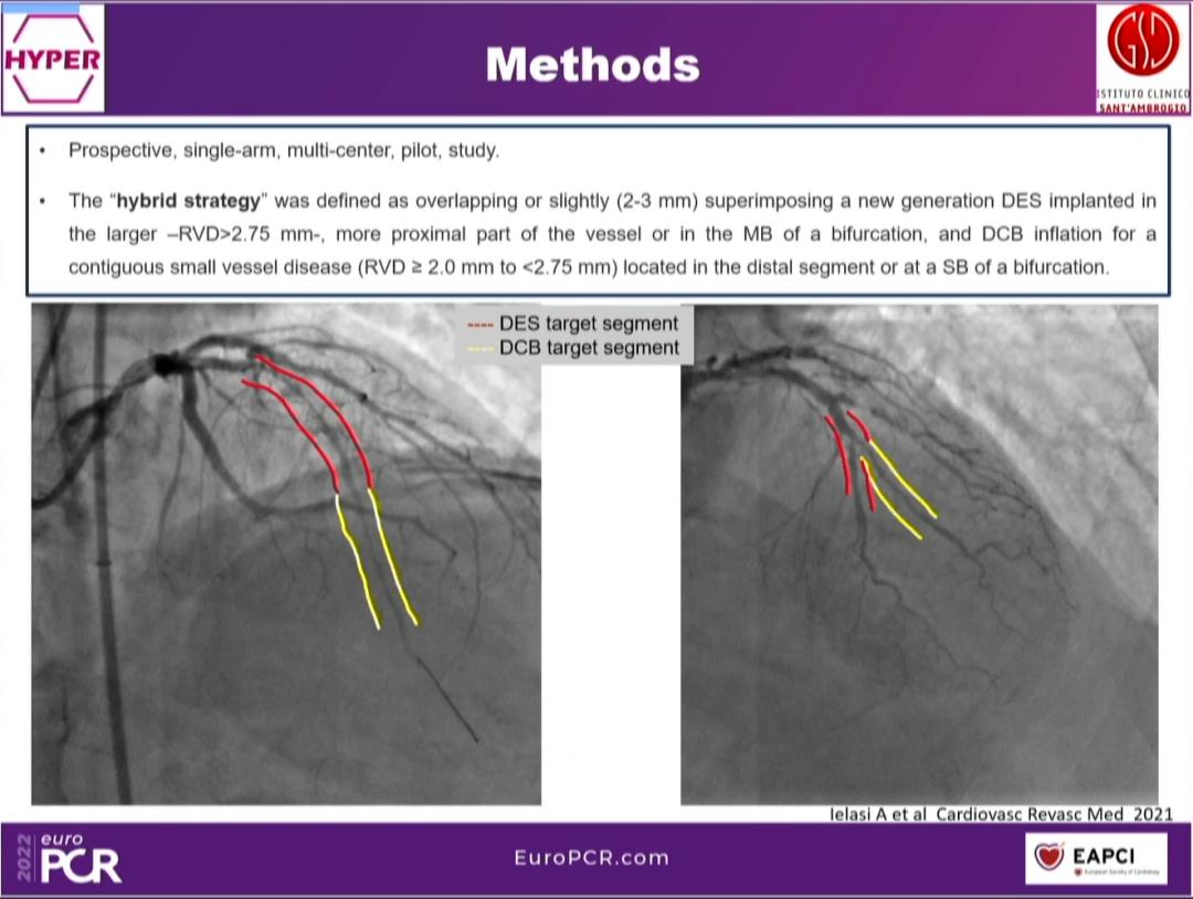 EuroPCR2022 | HYPER Study研究结果重磅发布 -- 严道医声网